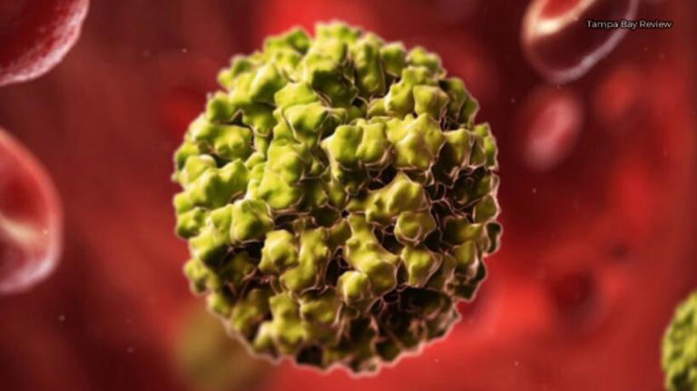 Norovirus on the rise in the Fargo-Moorhead area