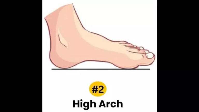 Personality Test: Your foot arch reveals if you are grounded or a free ...