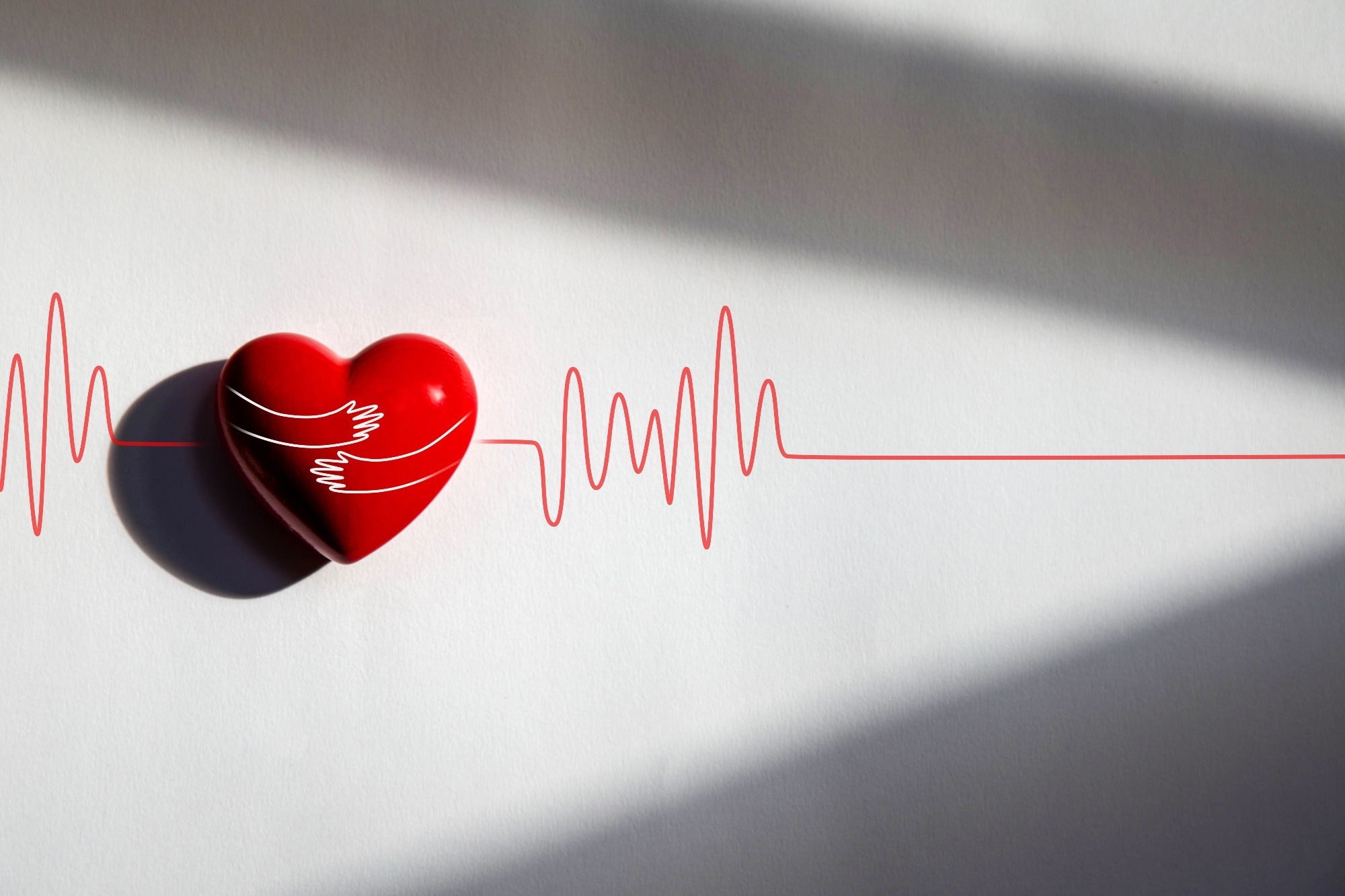 AI-Powered ECG Monitoring Could Transform Heart Failure Detection