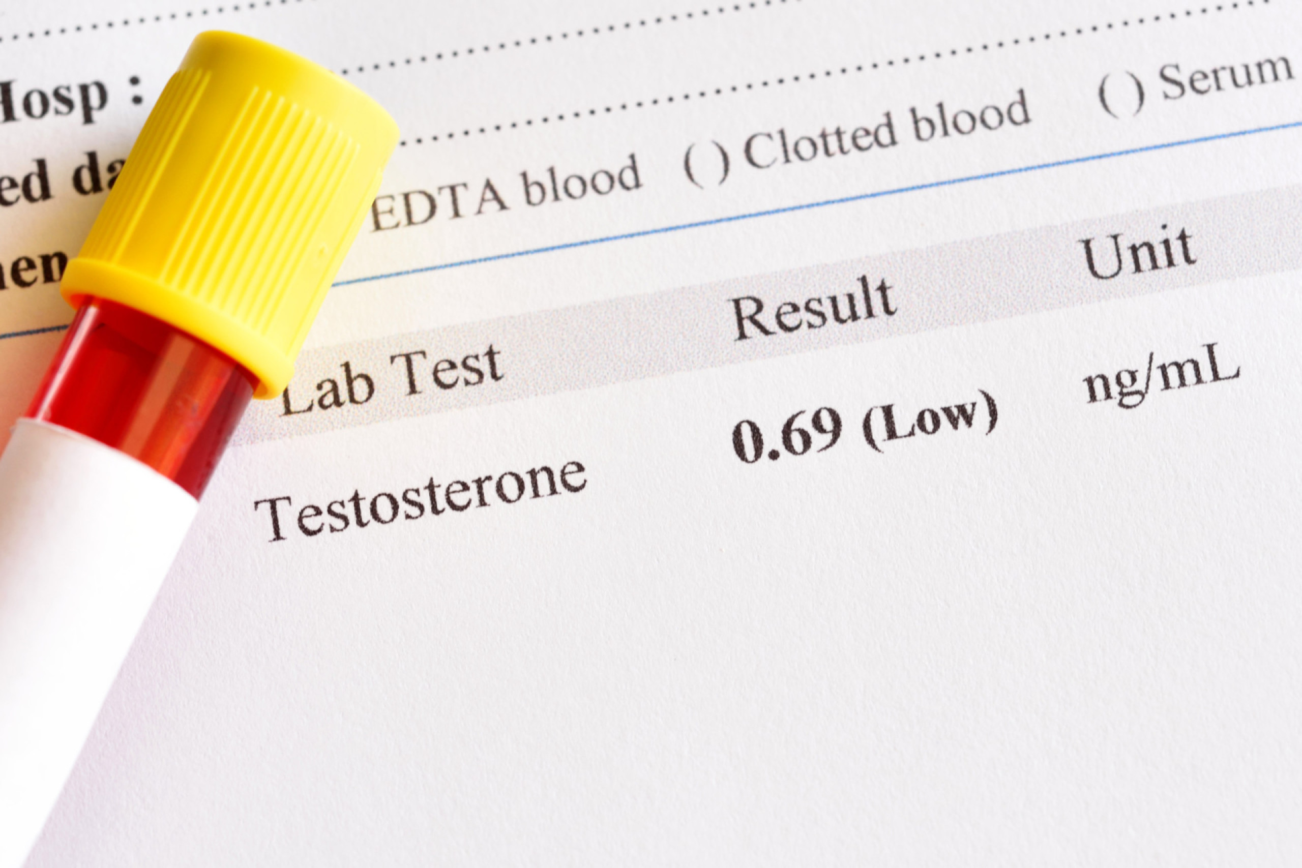 How to boost testosterone naturally