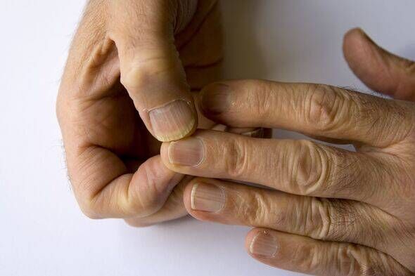 Expert says how quickly your fingernails grow indicates how fast you're ...