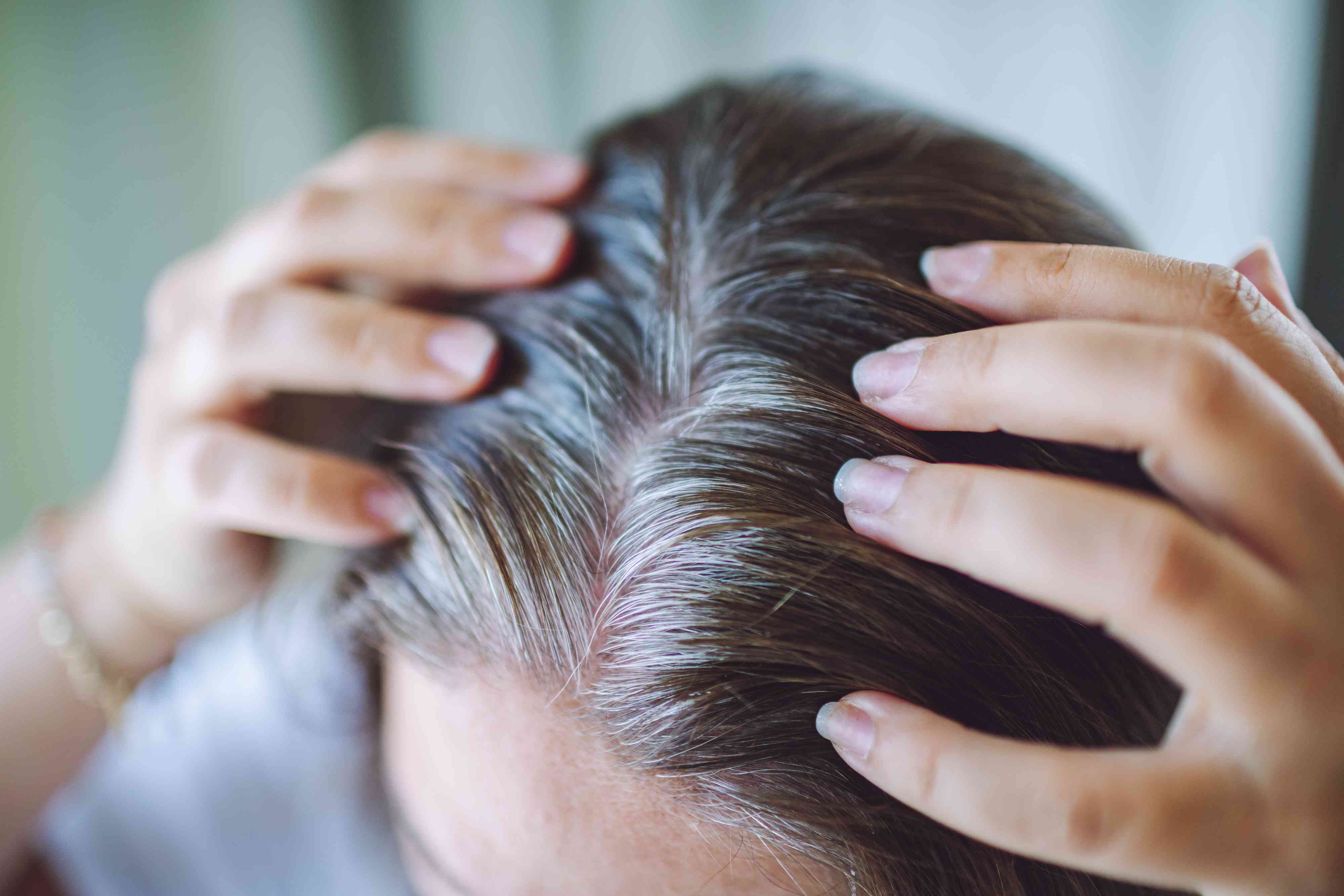 12 Ways to Moisturize Your Scalp and Keep It Hydrated