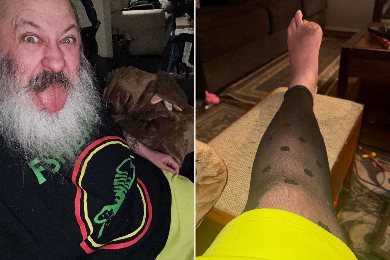 Former Bowling for Soup Guitarist Chris Burney Reveals He Lost 2 Toes ...