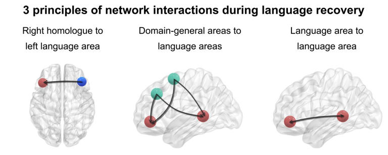 How the brain rewires itself for language recovery after a stroke
