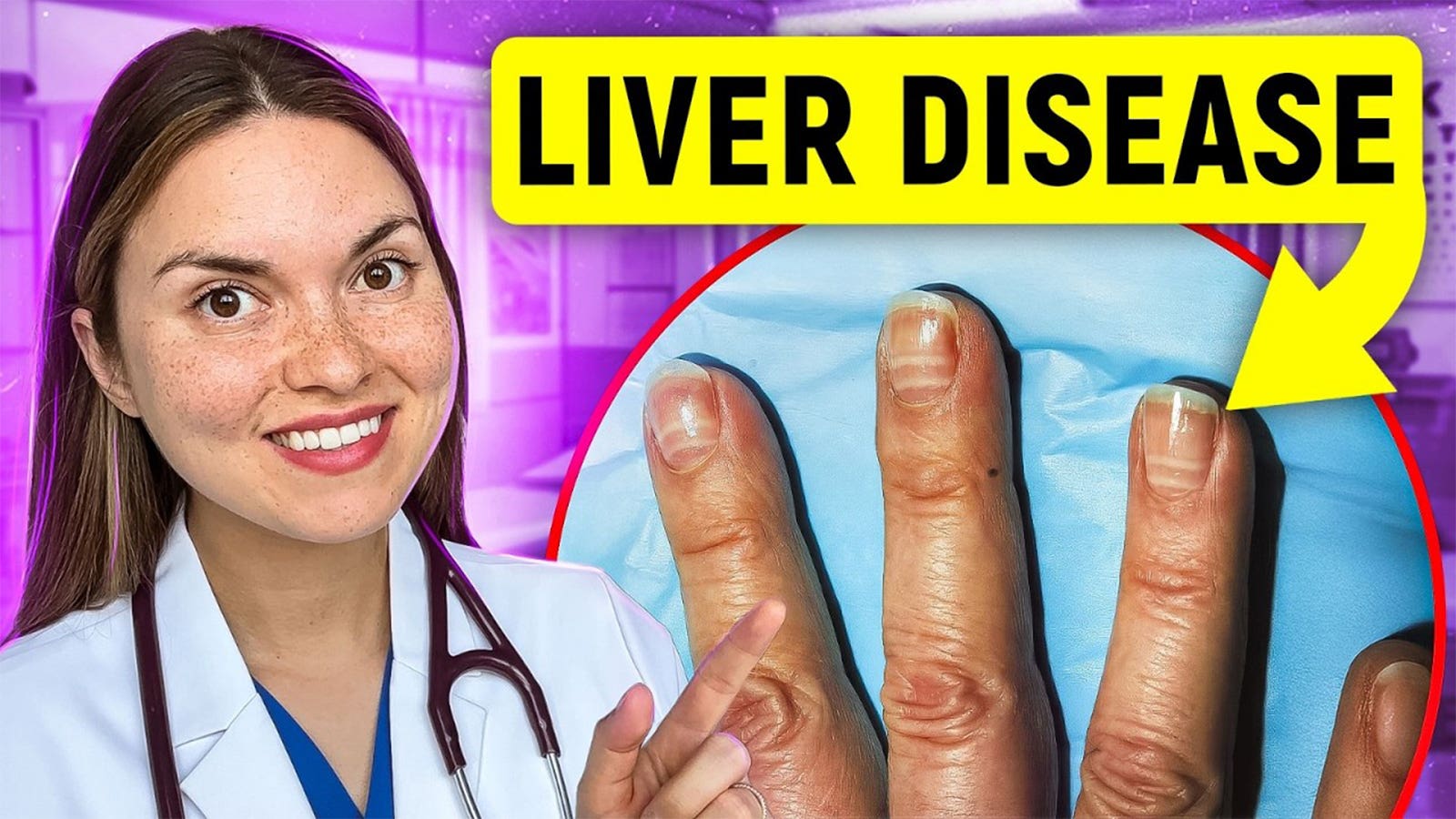 12 Signs of Liver Disease You Can See