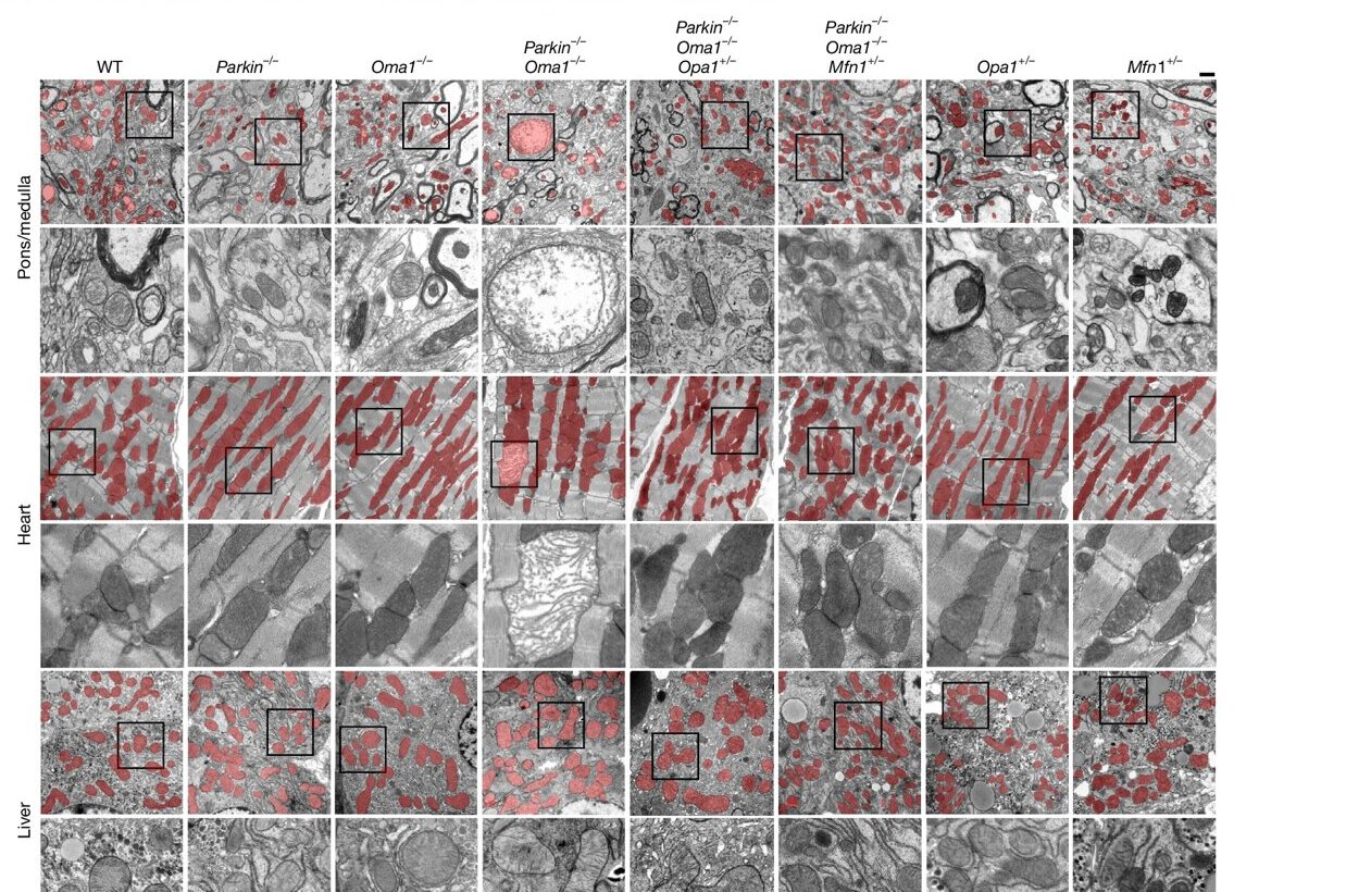 Dual mechanisms found to guard mitochondria against fusion-related damage