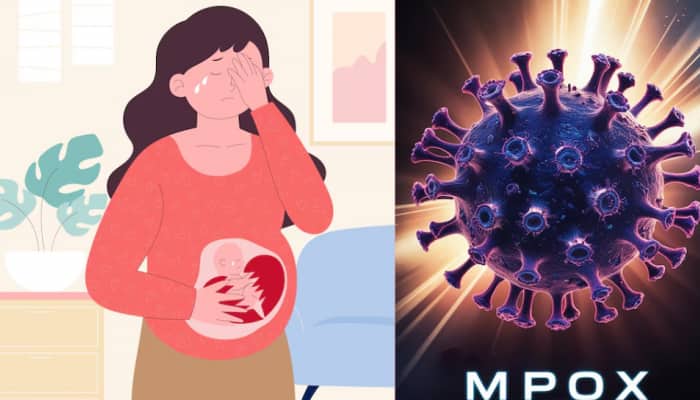 New Mpox Clade 1b Variant Raises Global Health Concerns With Higher ...