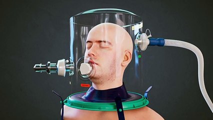 ELMO - CAPACETE DE RESPIRAÇÃO ASSISTIDA NÃO INVASIVA