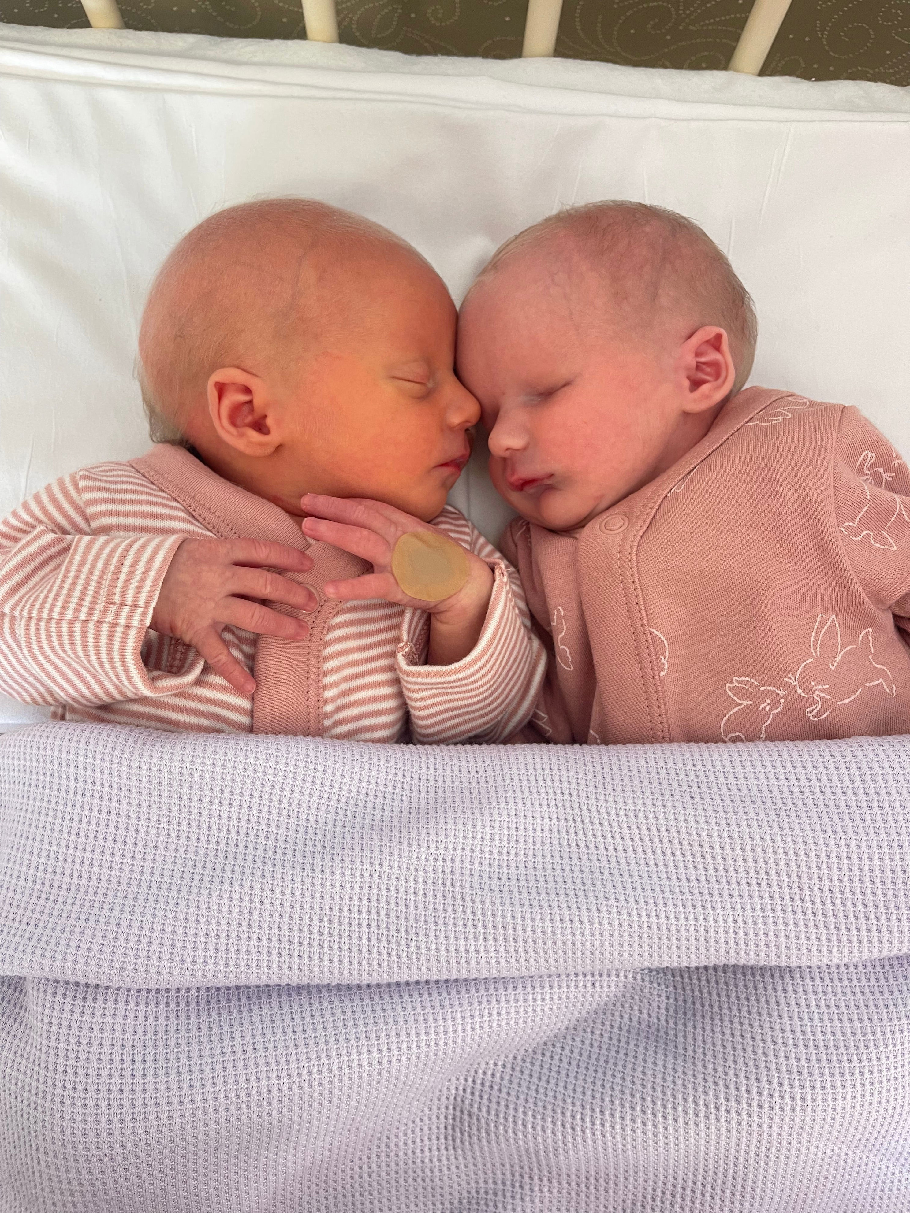 Baby born without eyes due to extremely rare condition