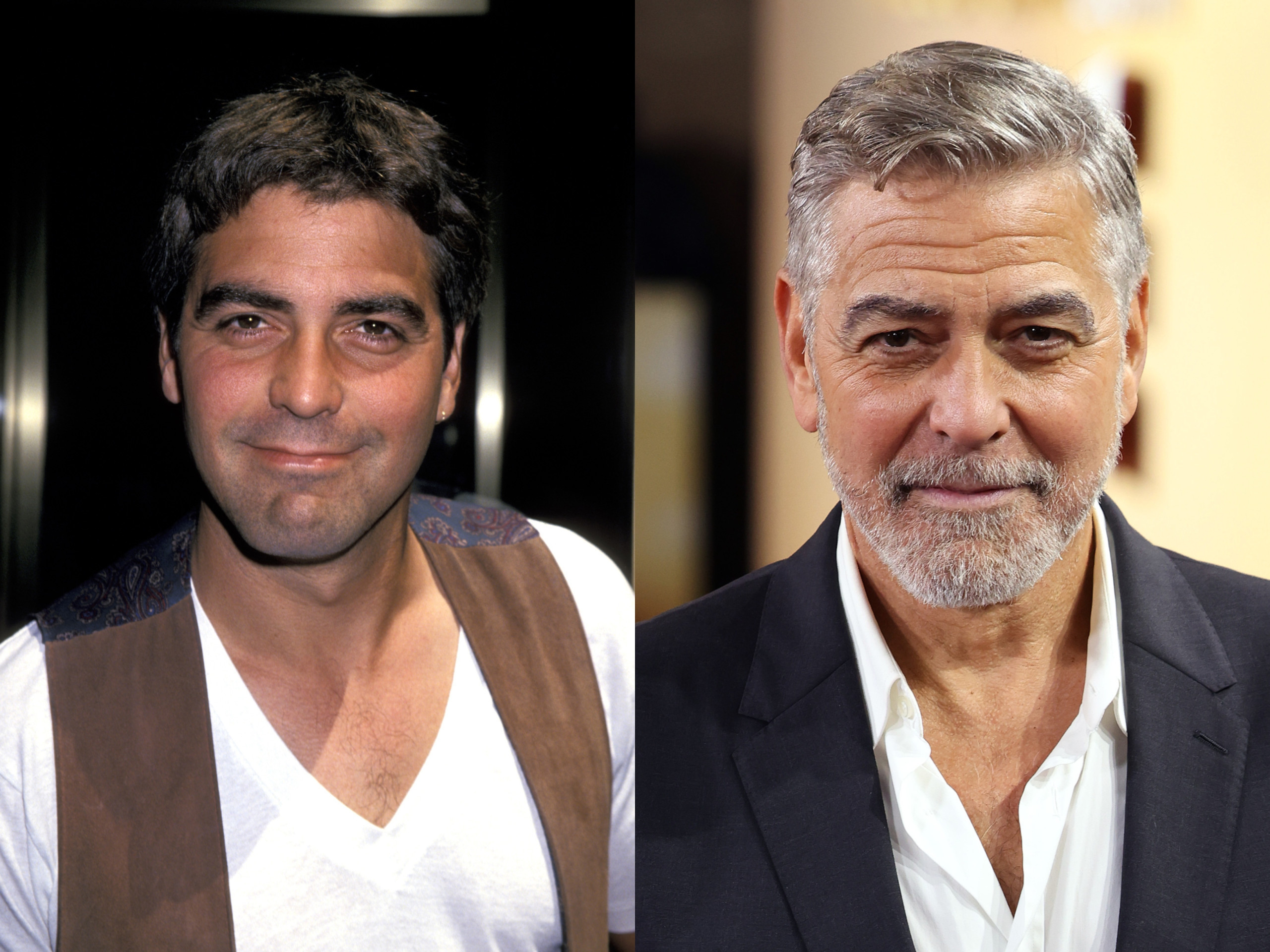 Prima e dopo: celebrità stravolte dalla chirurgia estetica