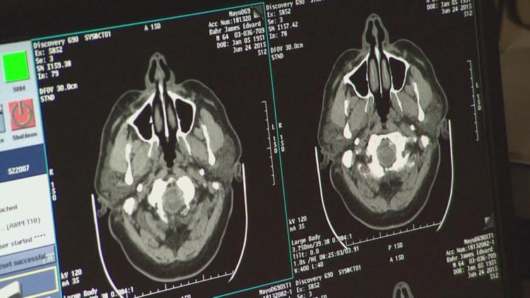 New research shows blood test could help detect Alzheimer's disease New research shows blood test could help detect Alzheimer's disease