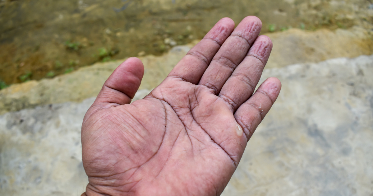 Why Your Fingers Wrinkle When They Get Wet And Why Some People’s Don’t