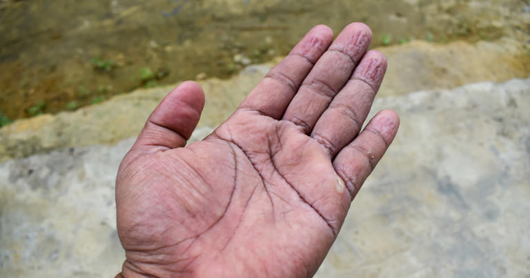 Why Your Fingers Wrinkle When They Get Wet And Why Some People’s Don’t