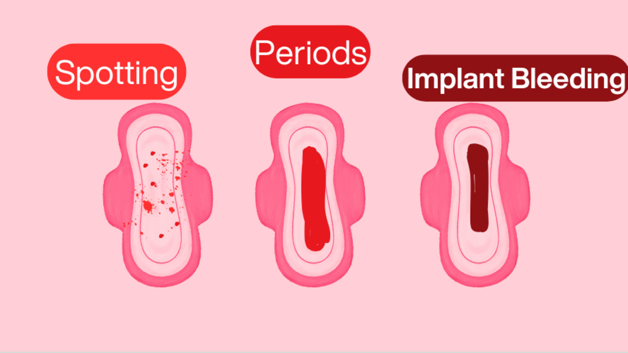 Spotting vs Period vs Bleeding: How To Identify