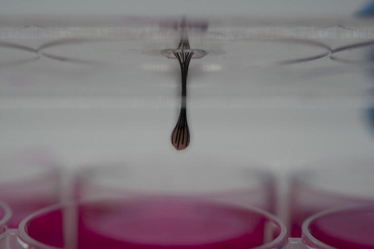 Scalable sensors lower the cost of studying genetic disorders