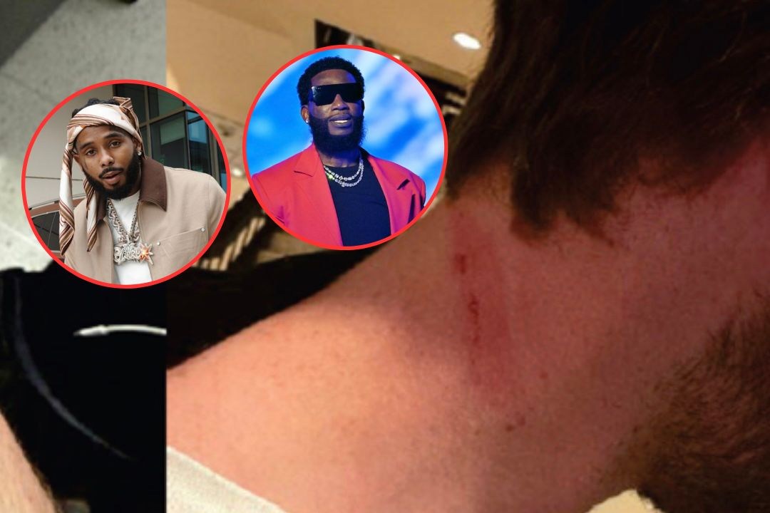 Photos show victim’s injuries and suspects showing off stolen jewelry ...