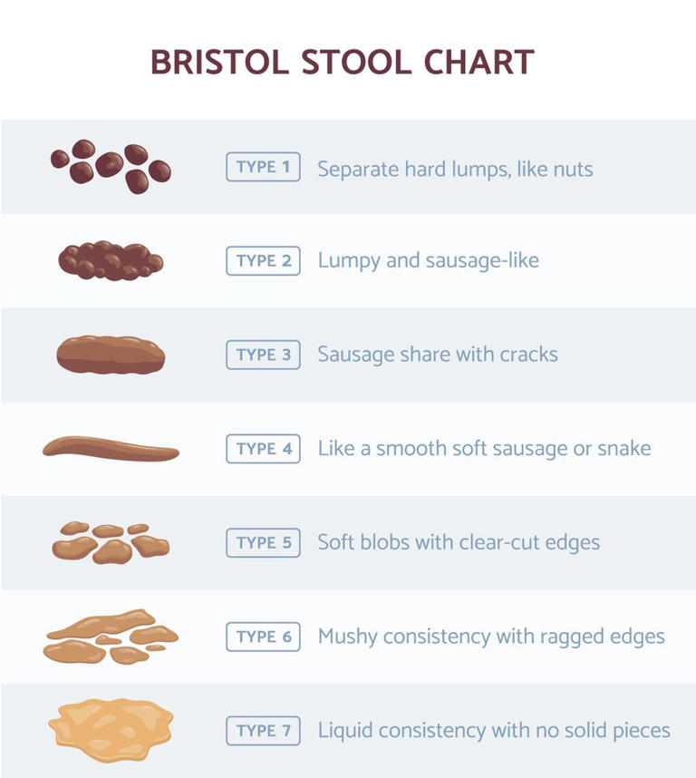 Ulcerative colitis stool: What you need to know