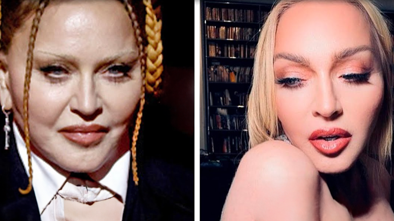 Plastic surgeon analyzes Madonna’s transformation