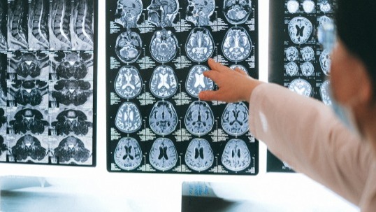 Why the human brain grew so large, explained by science