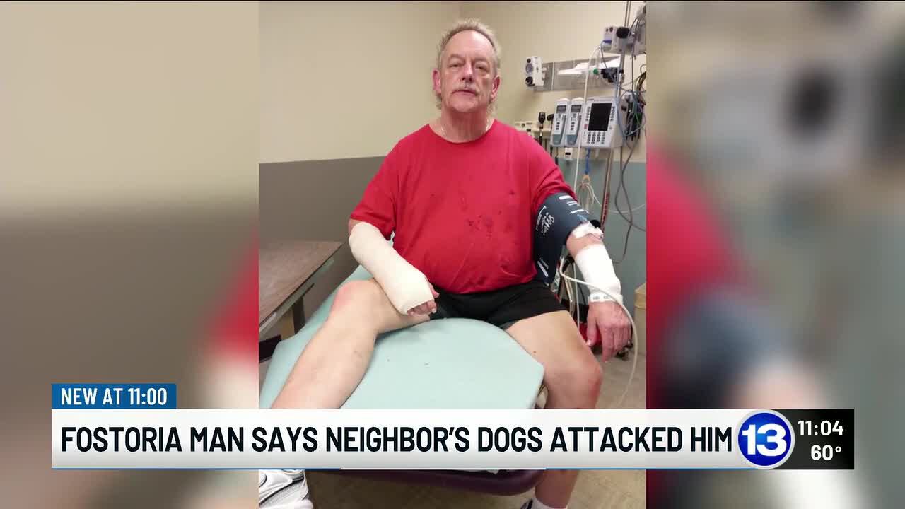 Fostoria man recovering after dog attack, chihuahua killed