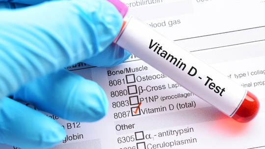 Are you taking too much vitamin D? Warning signs to watch for