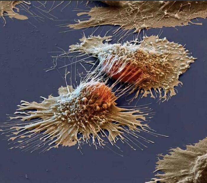 72 remarkable microscopic pictures showing things up-close