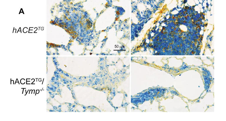 COVID-19's lingering shadow: The molecular link between SARS-CoV-2 and ...