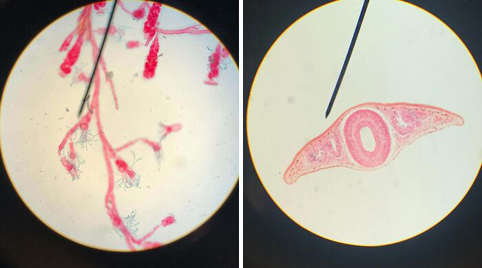 72 remarkable microscopic pictures showing things up-close