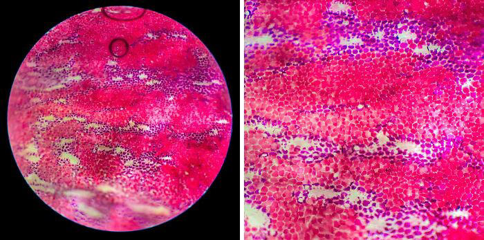 72 remarkable microscopic pictures showing things up-close