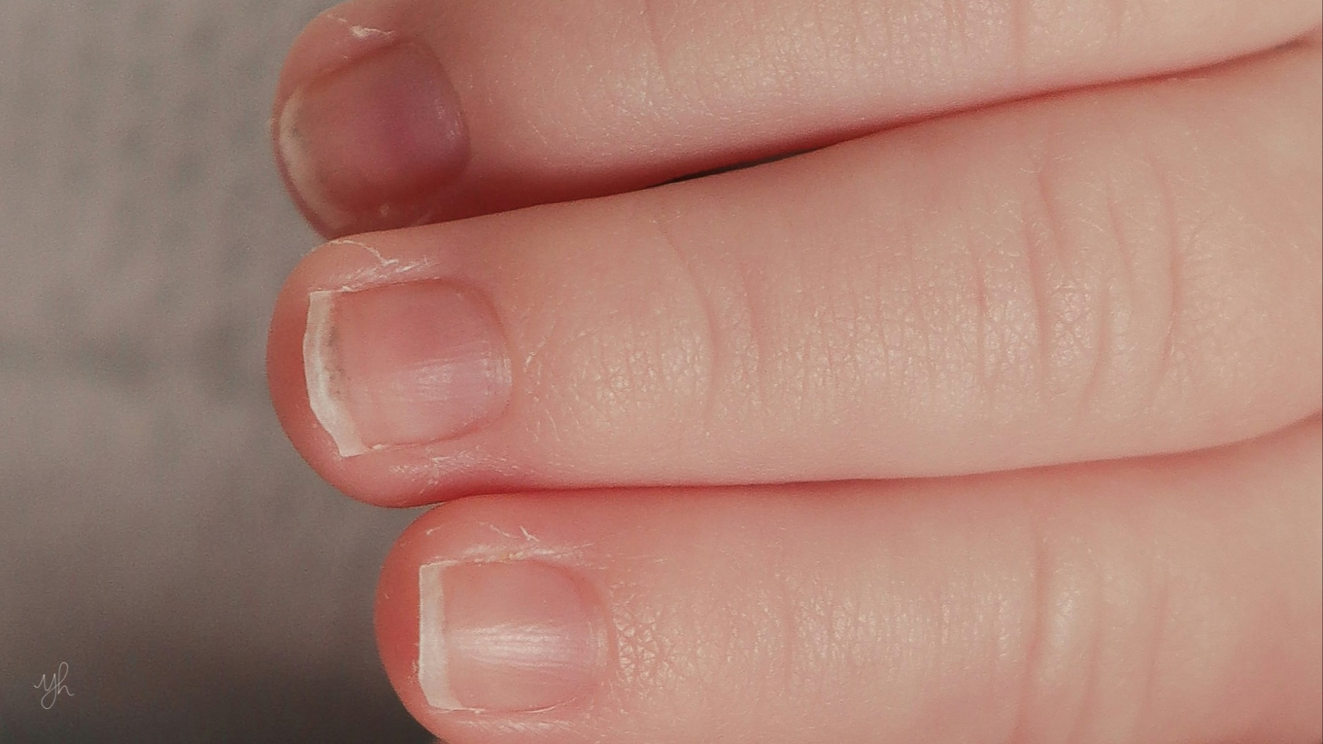 Nail health: 10 reasons your nails are brittle & 10 tips to strengthen them