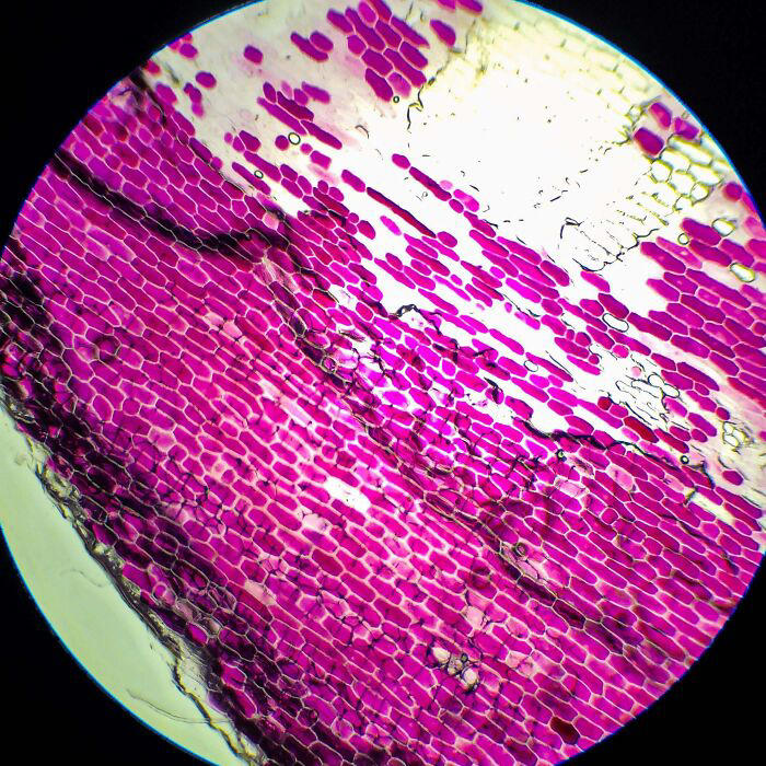 72 remarkable microscopic pictures showing things up-close