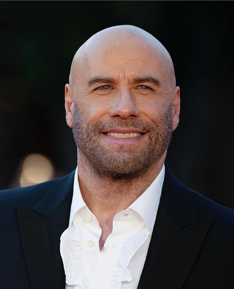 15 famous men who mastered the art of hiding hair loss