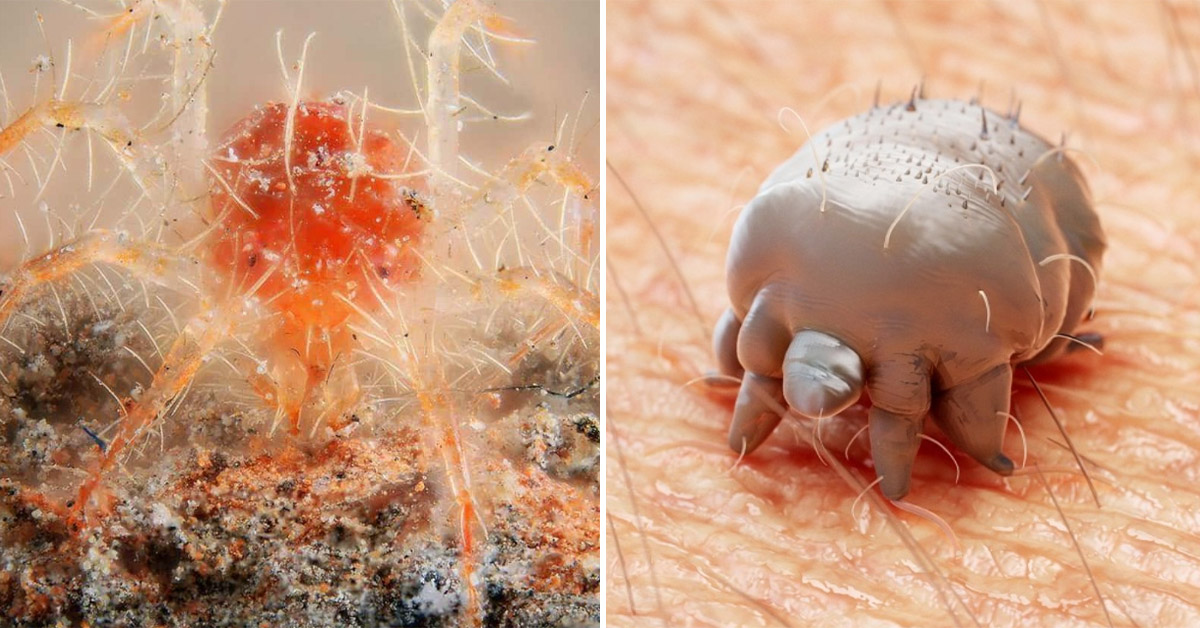 20 unsettling photos of the bugs and critters that live on us