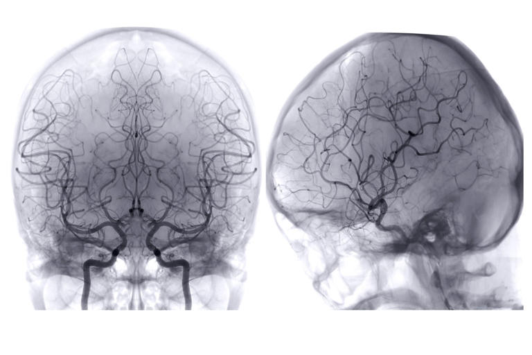 We could one day reanimate your mind after scientists preserve pig brain