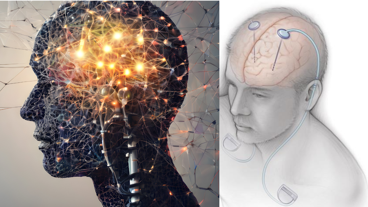 Beyond medicines: How DBS surgery is helping Parkinson’s patients ...