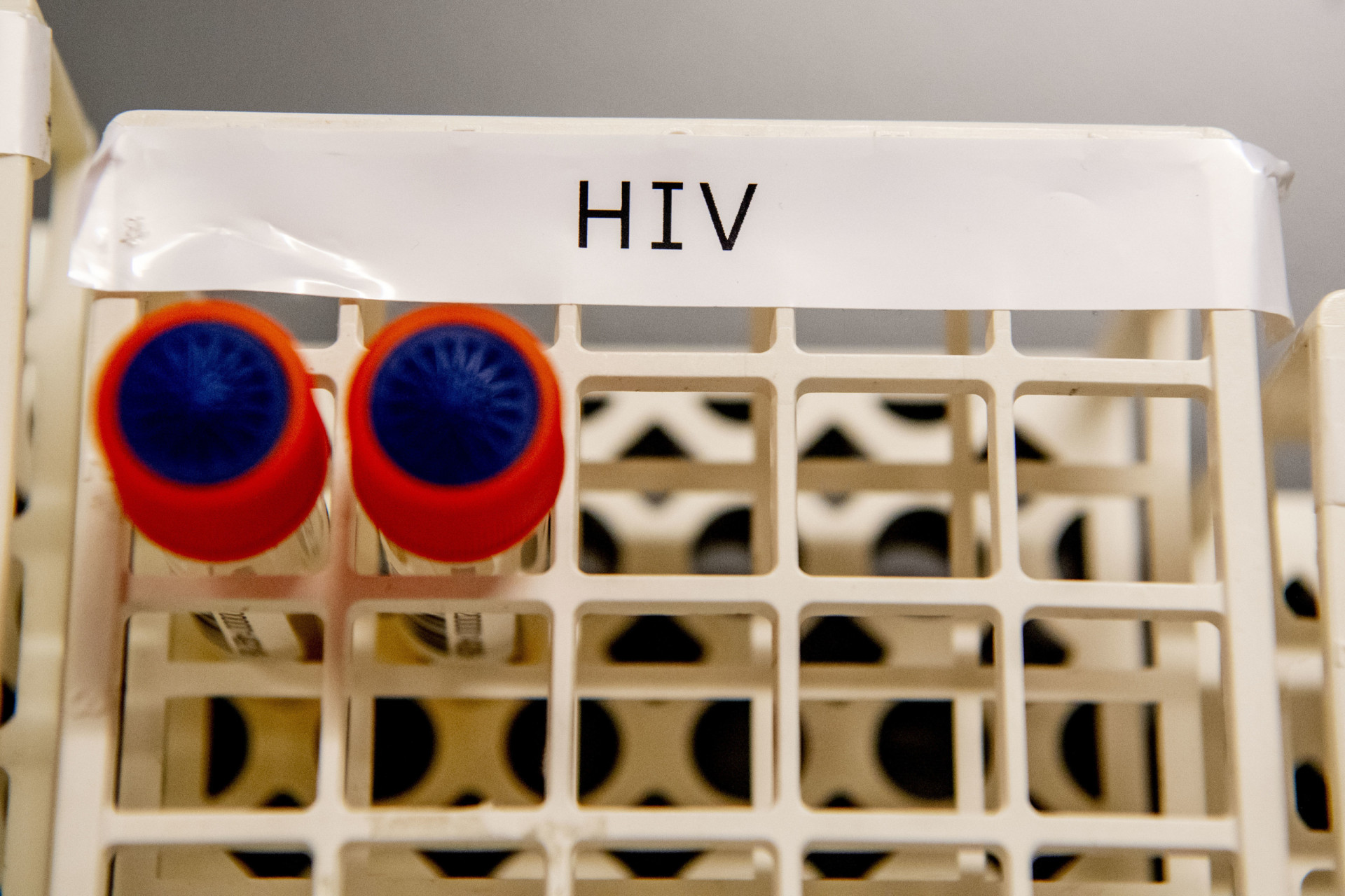 Body transformations when HIV patients stop medication