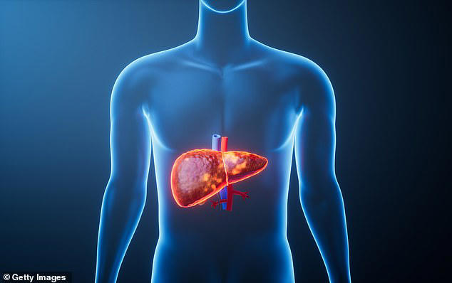 Deadly liver disease is now striking non-drinkers in record numbers ...