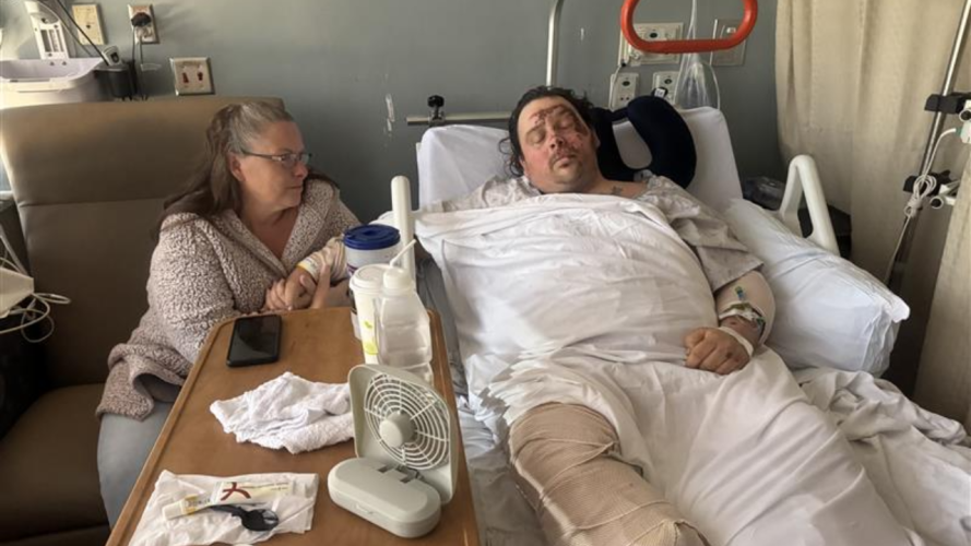 Hit and run victim pushes for motorcycle safety from hospital bed