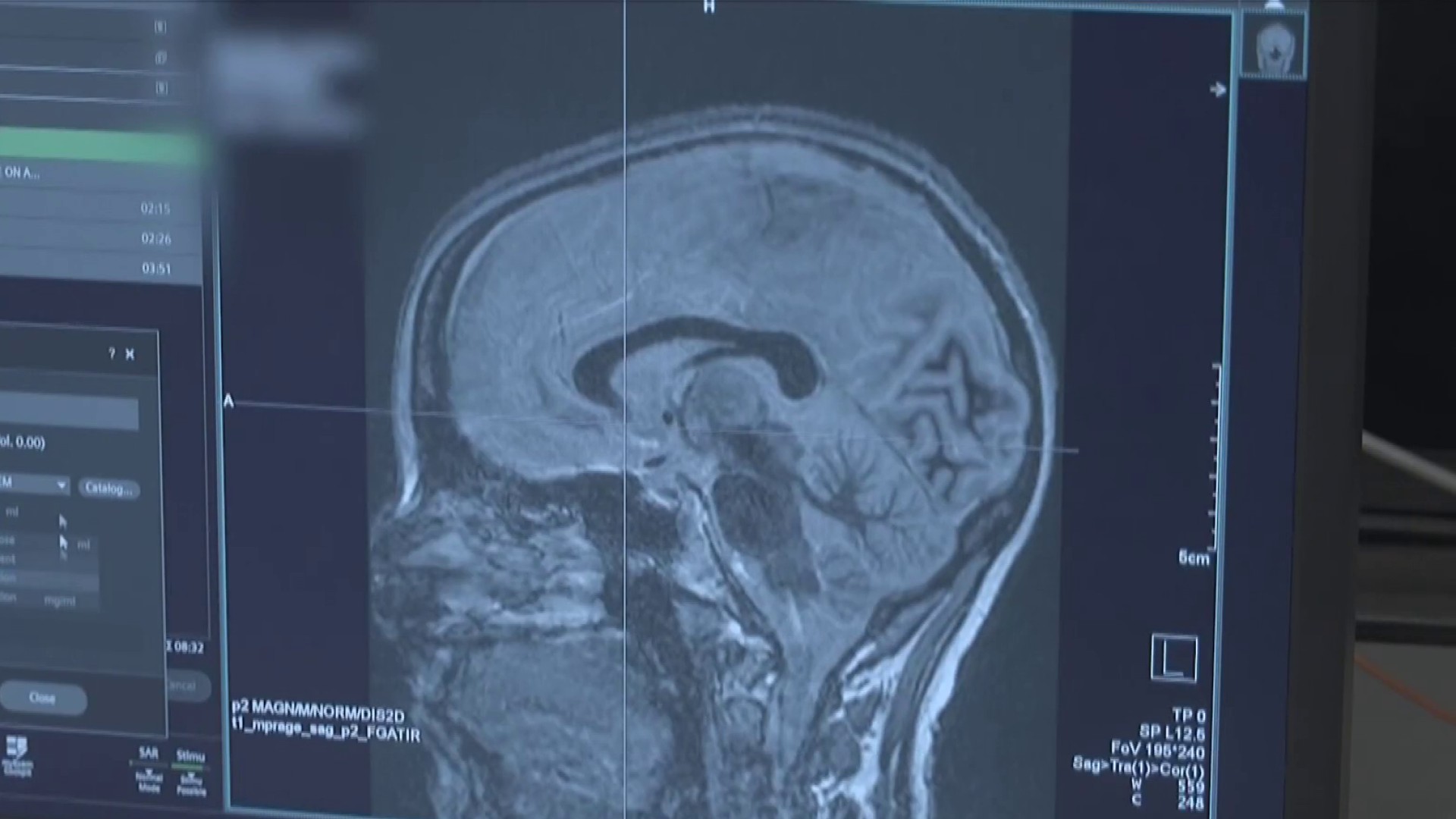 New technology offers hope for Parkinson’s patients