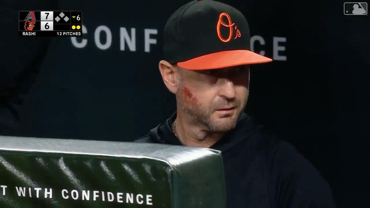 Moment: Orioles manager Craig Albernaz gets hit in his face by a foul ...