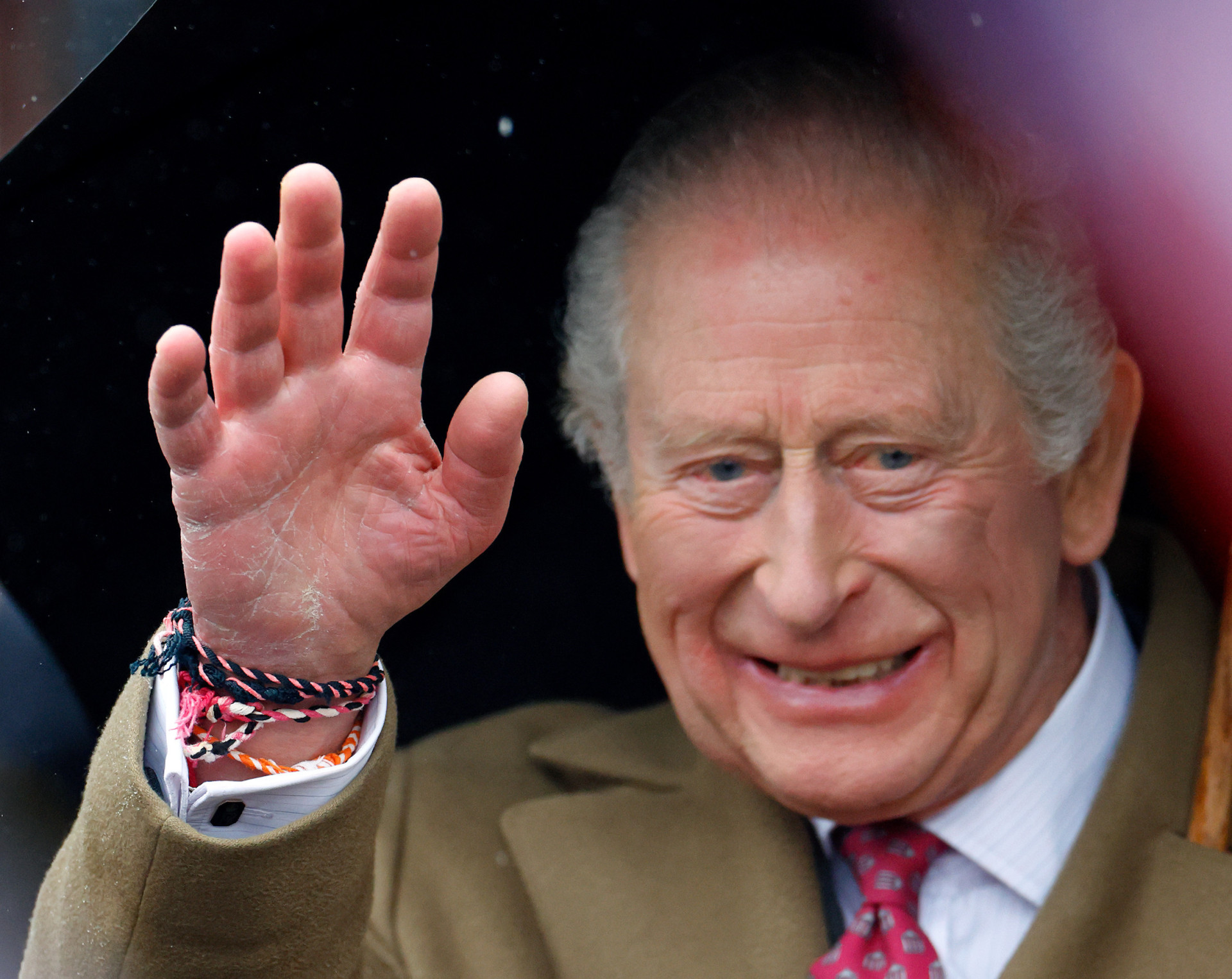 Modern-day royals and their medical conditions
