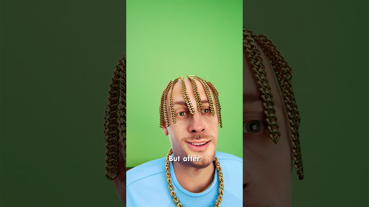 Rapper implants gold hair 😳