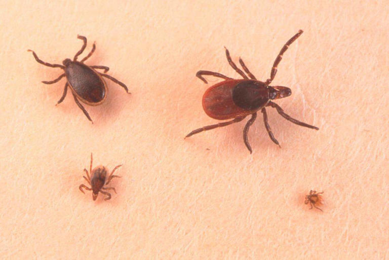 Tick-borne illness in kids is spreading across the US - What every ...