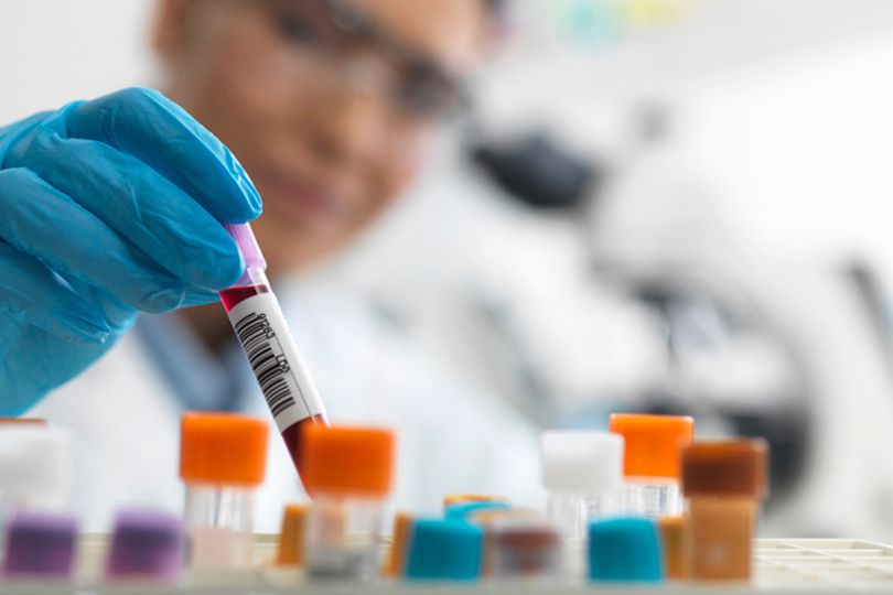 Symptoms of deadly mystery virus that's spreading after it kills 5 ...