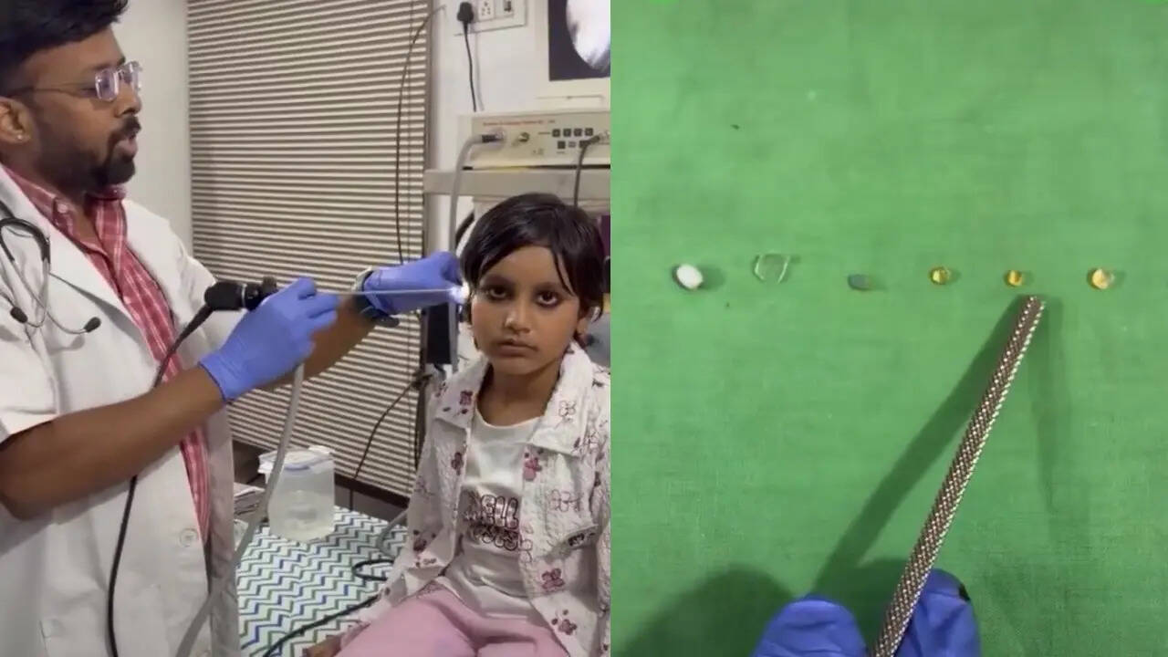 Doctor finds 7 shocking objects inside child’s ear after complaint of ...