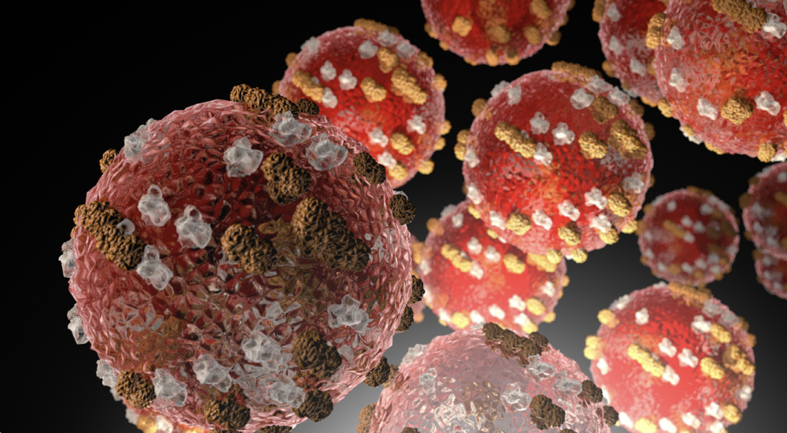 Measles case confirmed in southeast Washington. Patient was not vaccinated