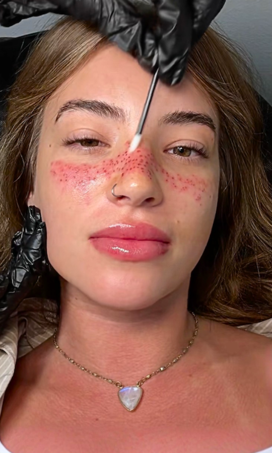 Would you get a freckle tattoo?👀