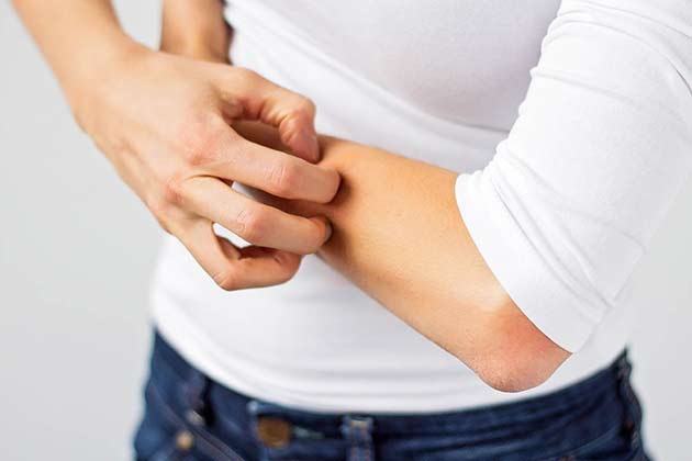20 eczema symptoms that aren’t always obvious
