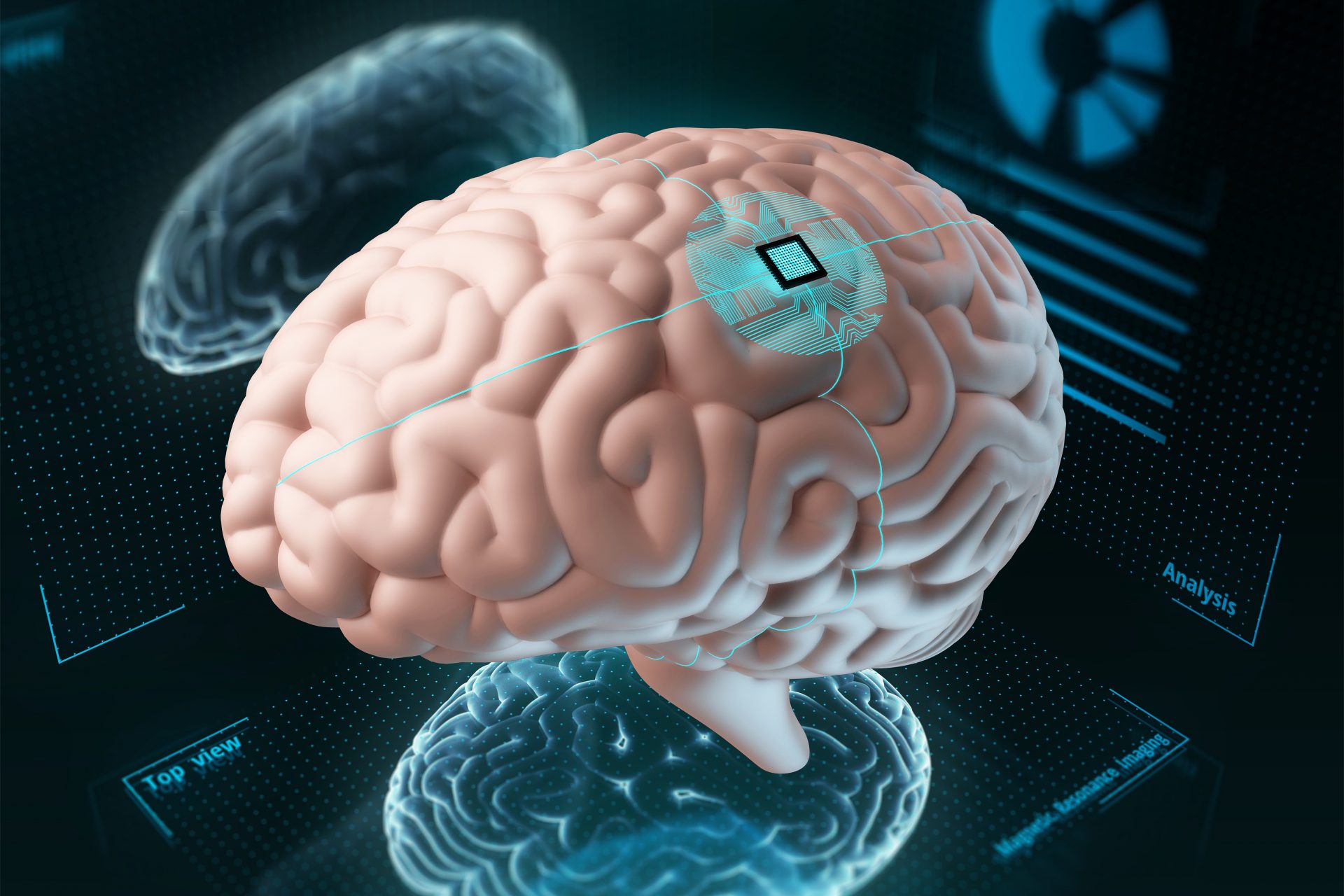 Hope or hype? Brain implants for depression