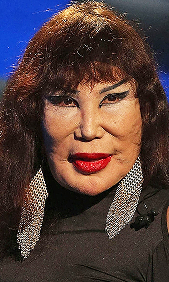 Pregnant at 68?